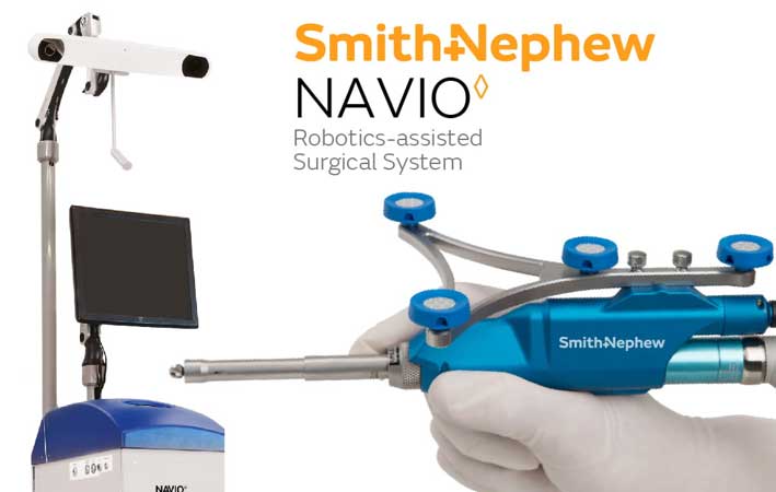 Robot-geassisteerde knieprothese ROSA - Orthopedie - AZ Sint-Lucas